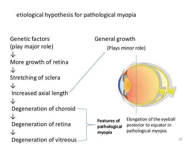 myopia