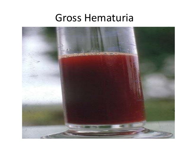Symptomatology of genito urinary system