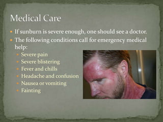 Sunburns at a glance | PPSX