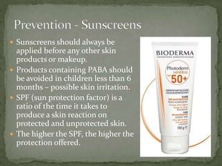 Sunburns at a glance | PPSX