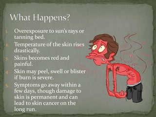 Sunburns at a glance | PPSX