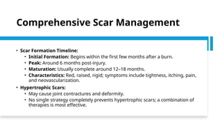 BURN REHABILITATION - a basic presentation on positioning and splinting ...