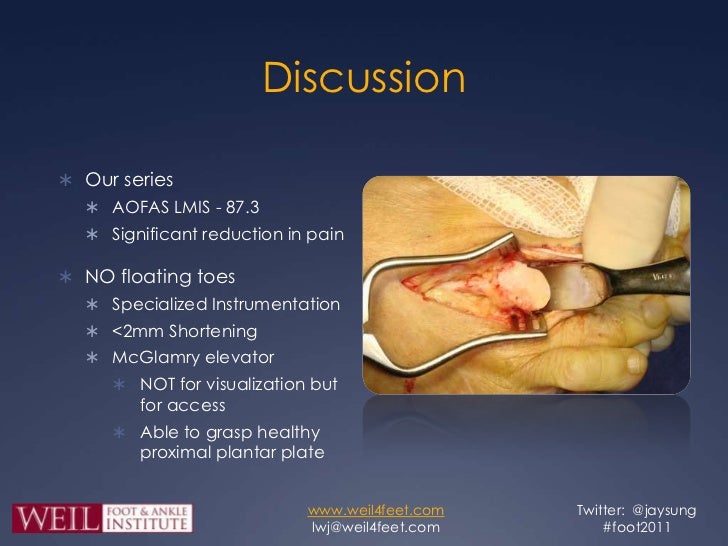 Dorsal Anatomic Plantar Plate Repair
