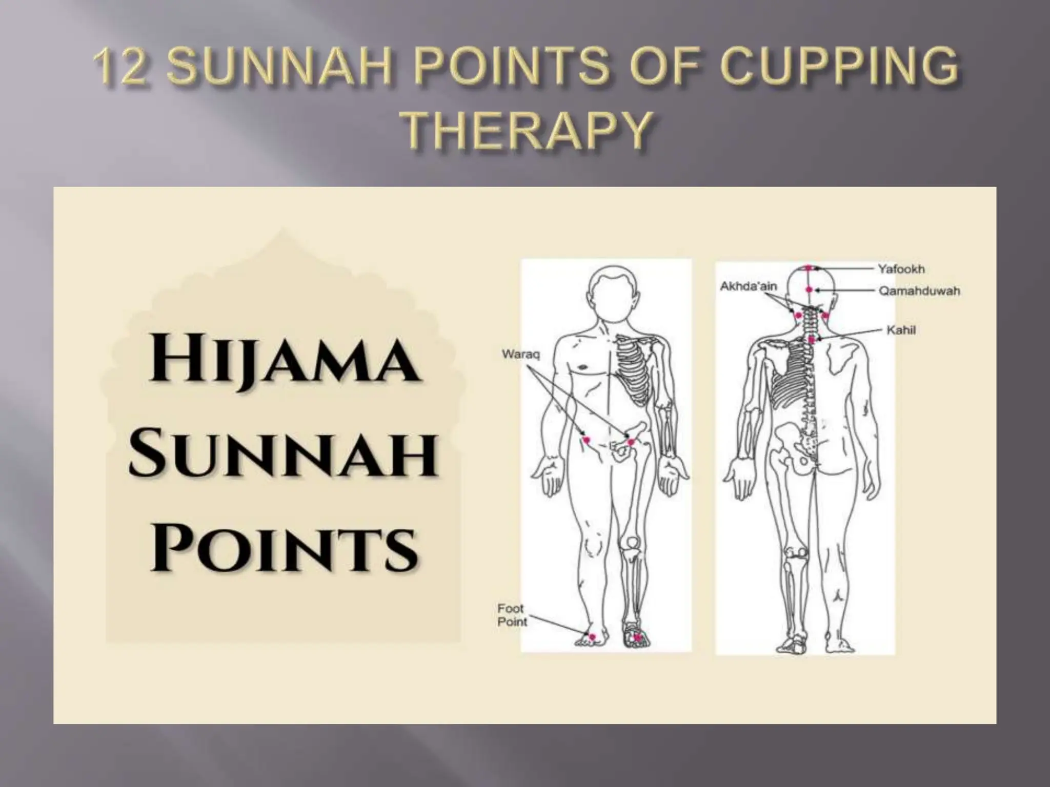 12 sunnah points of cupping or hijama therapy | PPTX