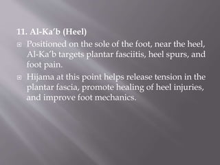 12 sunnah points of cupping or hijama therapy | PPTX | Death, Injury ...