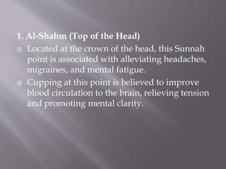 12 sunnah points of cupping or hijama therapy | PPTX | Death, Injury ...