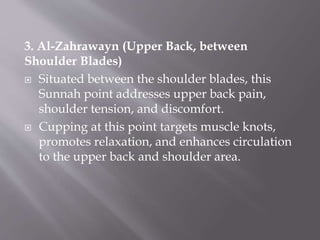 12 sunnah points of cupping or hijama therapy | PPTX | Death, Injury ...