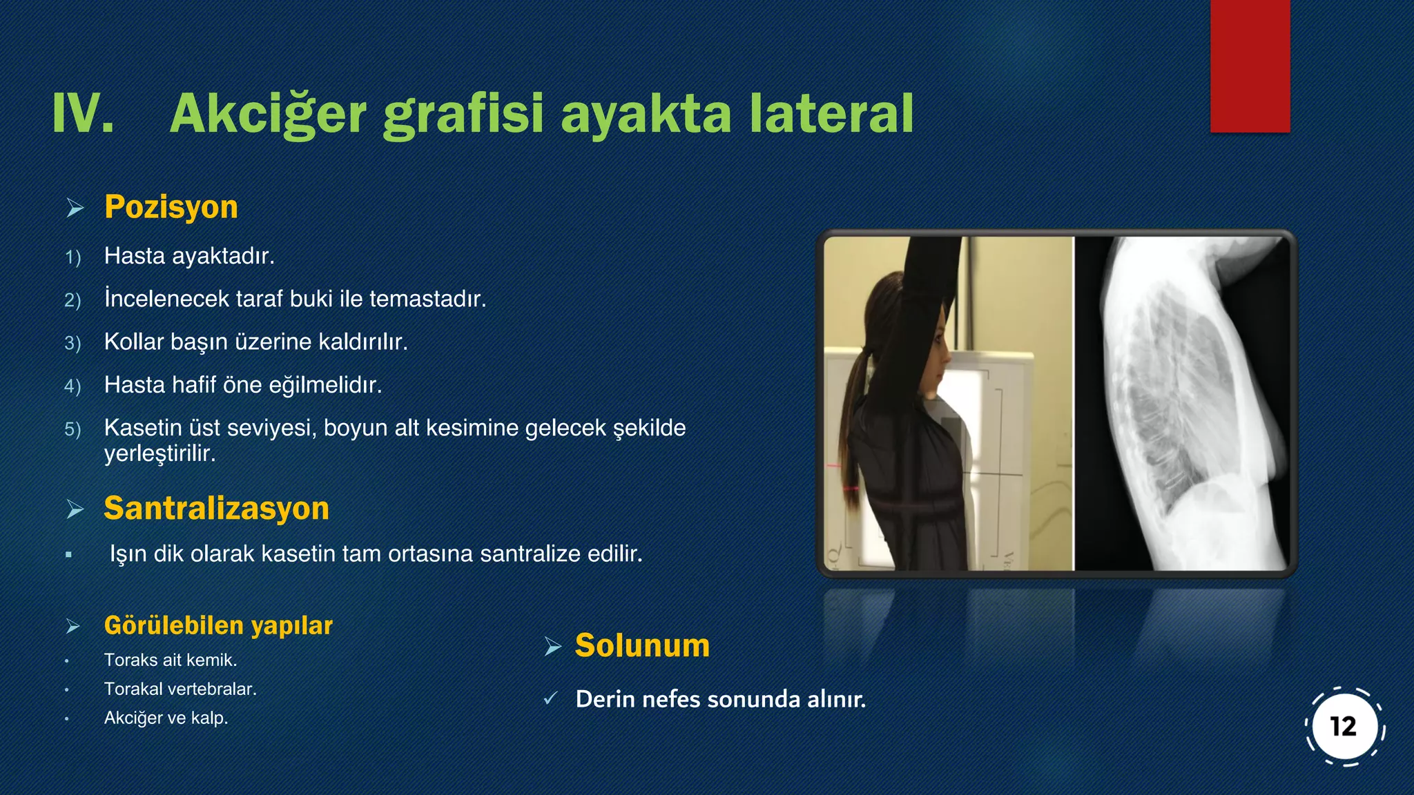 Sunum-_Toraks_radyografileri- PDF.pdf