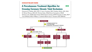 I. Doğu Kılıç - Flash Highlights: Global CTO algorithm – PART I ...