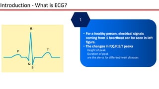 Interpretation of electrocardiography (ECG) by using polynomial ...