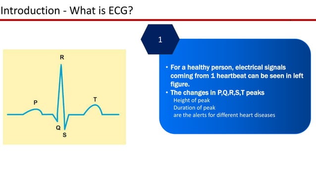 Interpretation of electrocardiography (ECG) by using polynomial function simulation | PPT