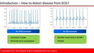 Interpretation of electrocardiography (ECG) by using polynomial function simulation | PPT