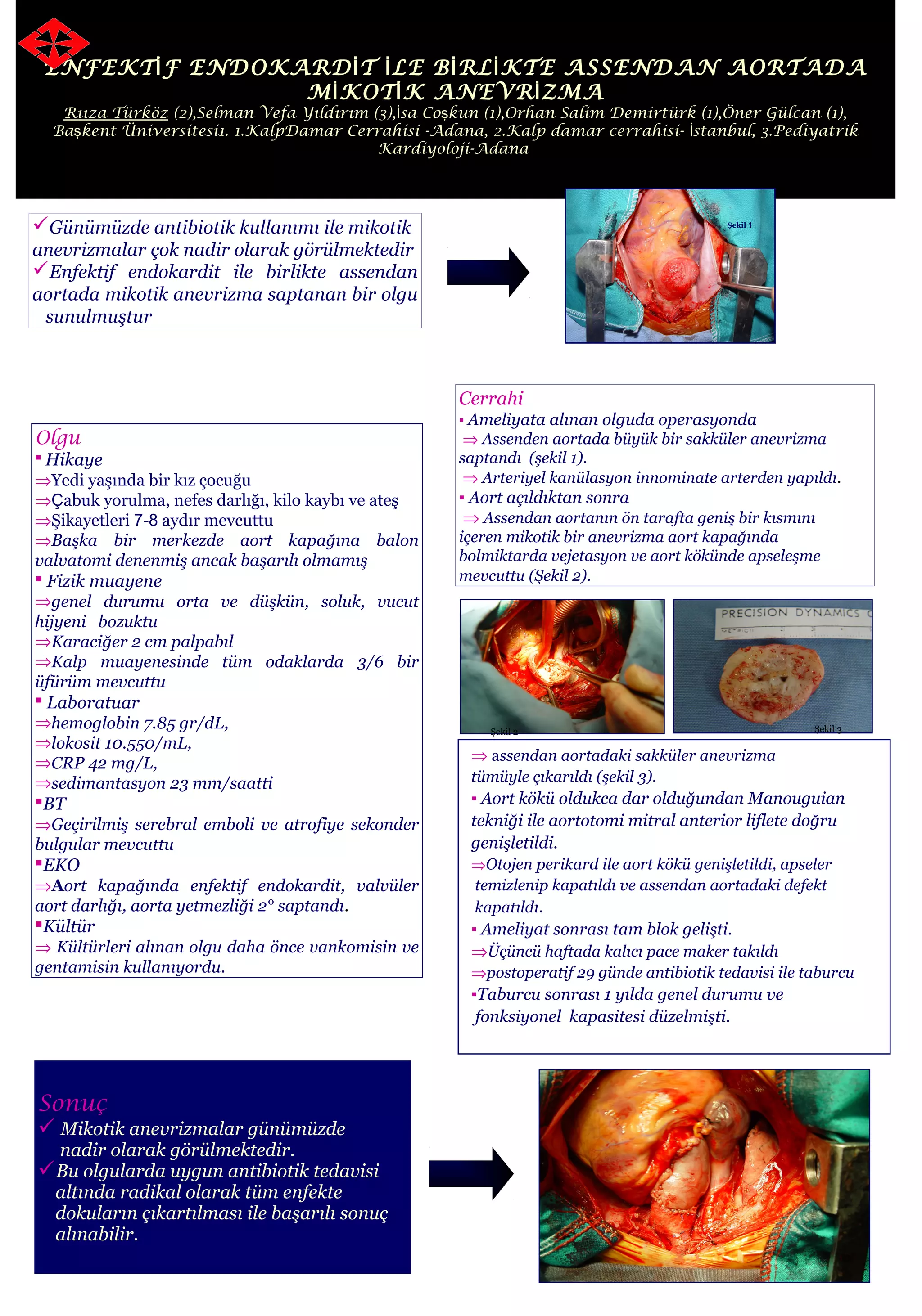 ENFEKTİF ENDOKARDİT İLE BİRLİKTE ASSENDAN AORTADA MİKOTİK ANEVRİZMA | PPT