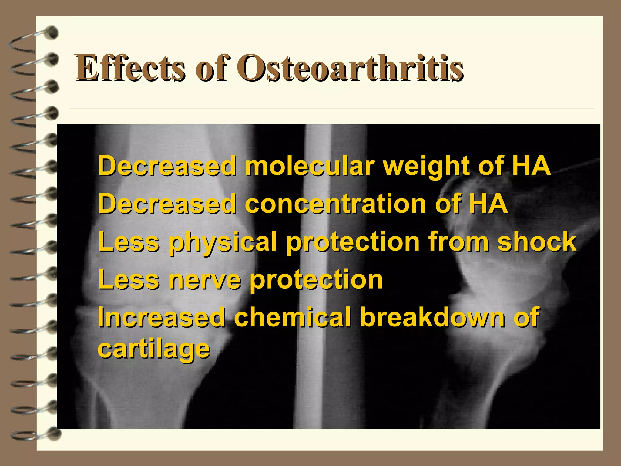 Supartz injection techniques | PPT