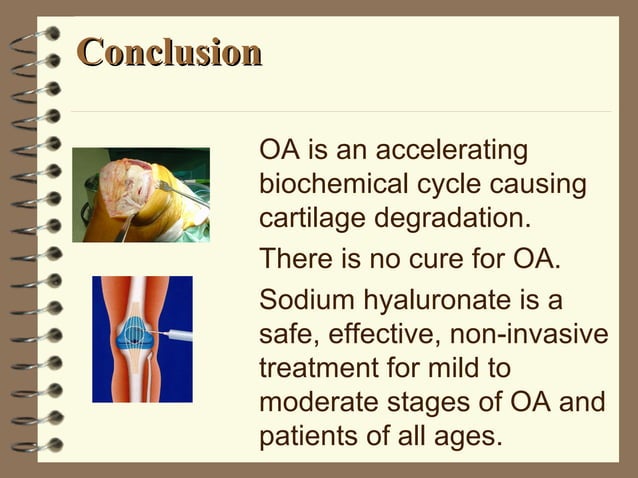 Supartz injection techniques | PPT