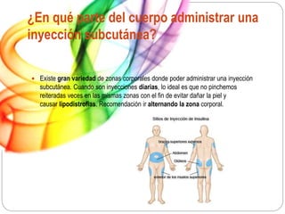 inyeccion Supcutanea | PPTX