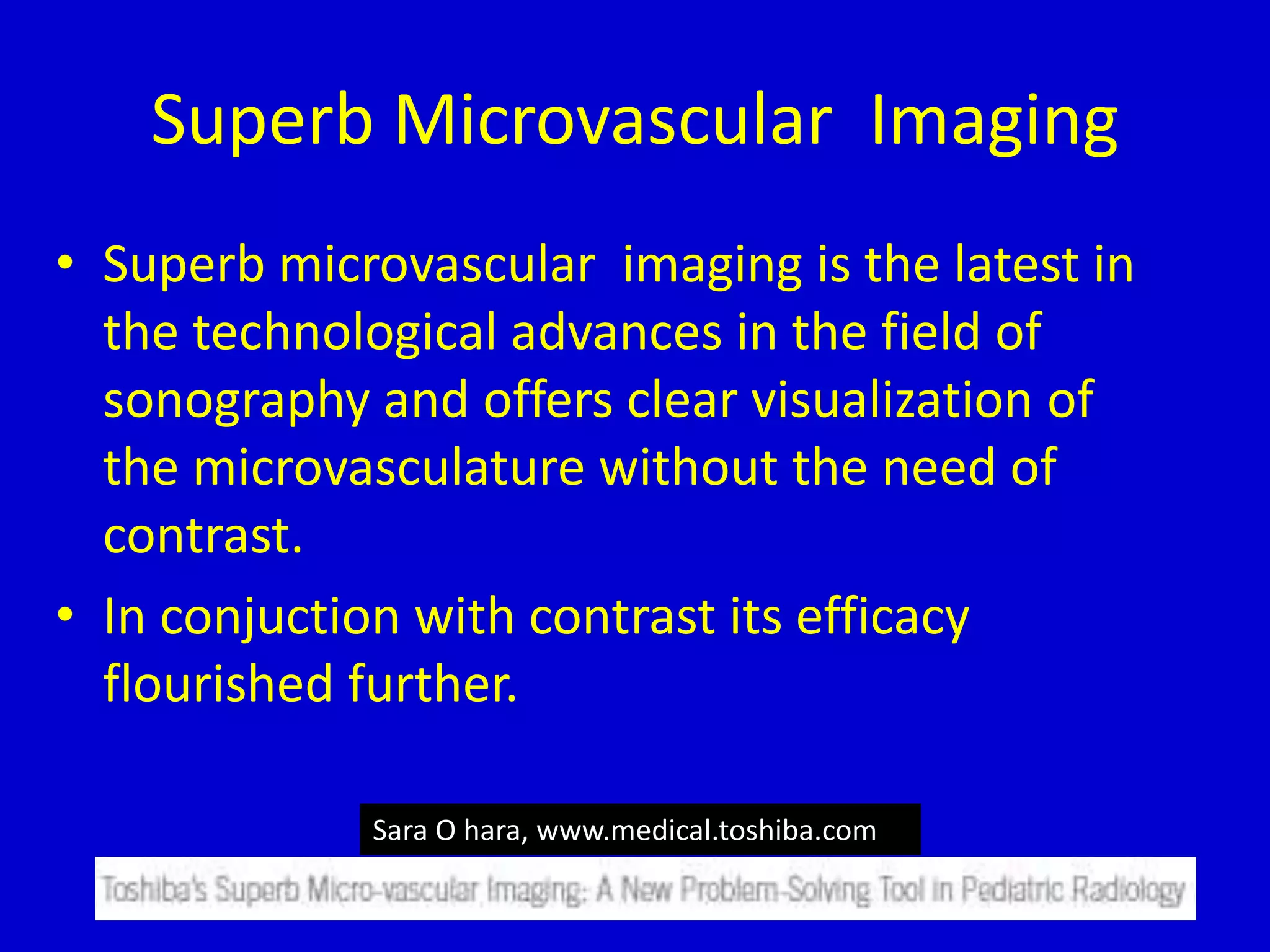Superb microvascular imaging A Sonographic Technical AdvanceDr ...