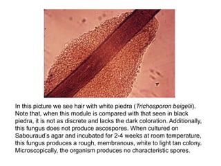 Superficial and cutaneous mycoses | PPTX