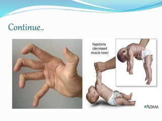 Superficial and deep reflexes! | PPTX