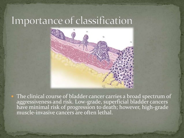 Superficial bladder cancer | PPTX | Cancer | Diseases and Conditions