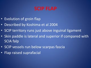 Superficial circumflex iliac artery perforator flap | PPTX