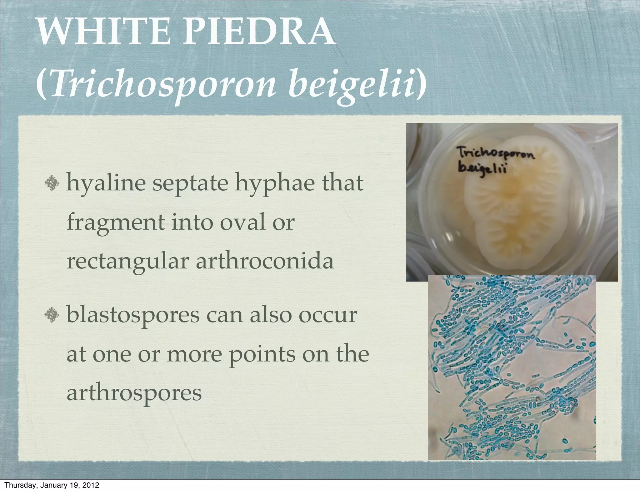 Superficial:cutaneous mycoses | PDF