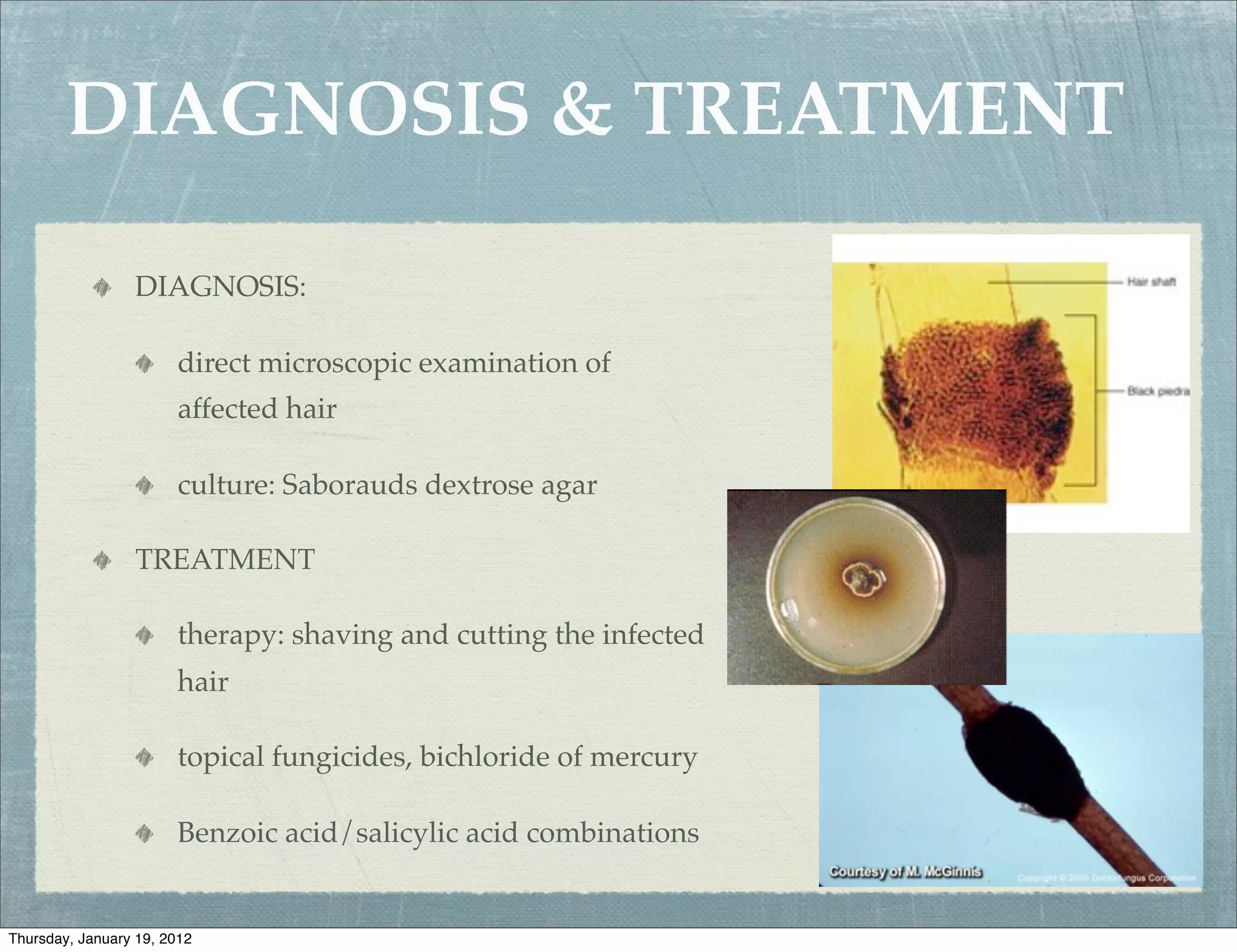 Superficial:cutaneous mycoses | PDF
