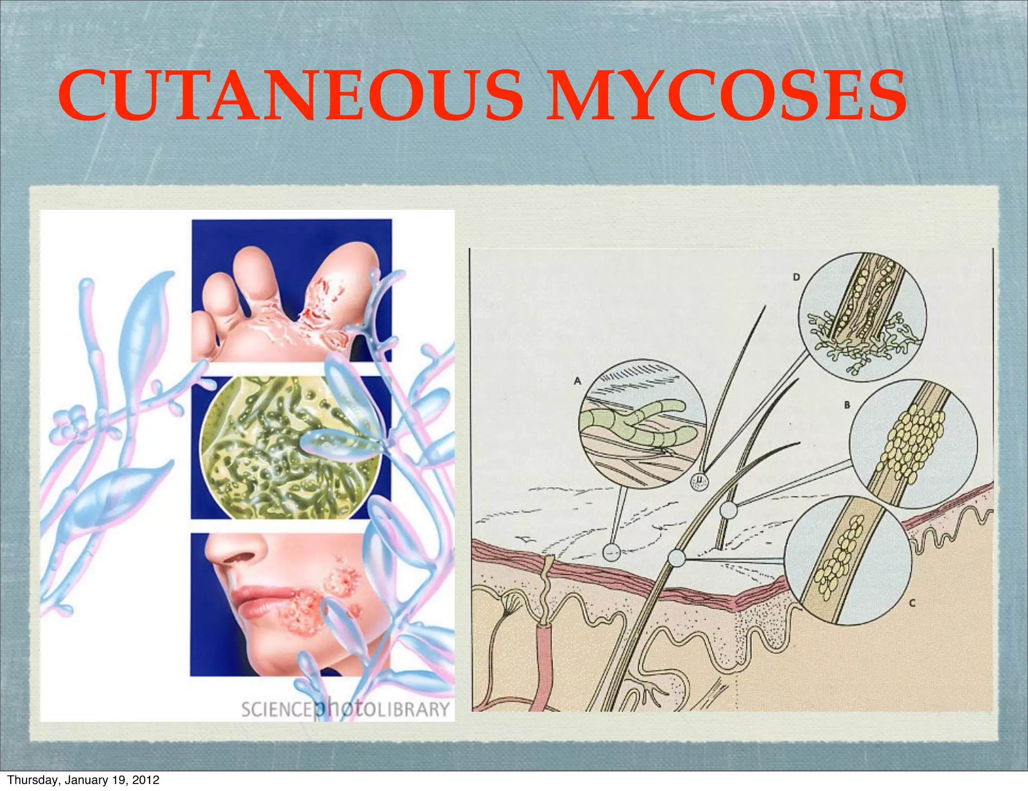 Superficial:cutaneous mycoses | PDF