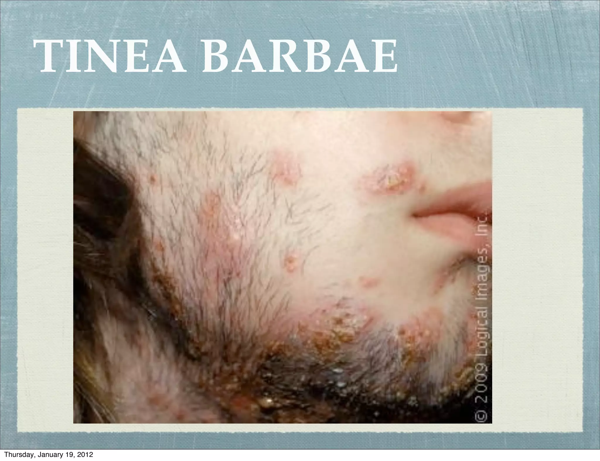 Superficial:cutaneous mycoses | PDF | Skin and Dermatology | Diseases ...