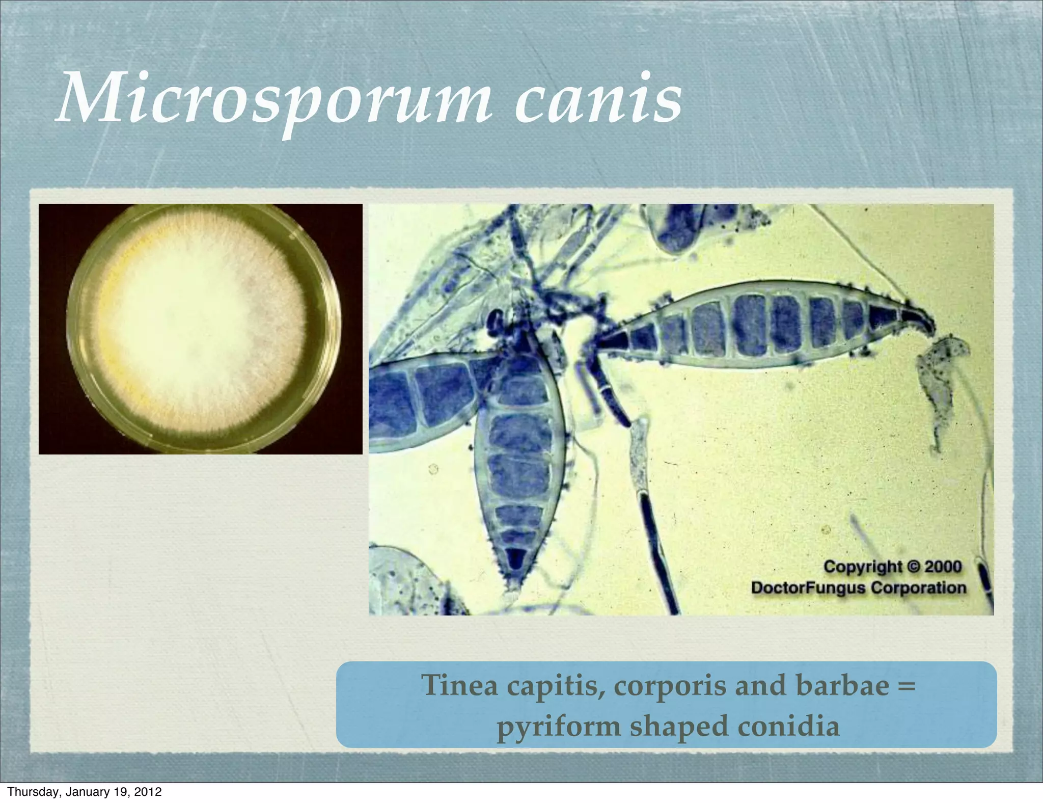 Superficial:cutaneous mycoses | PDF
