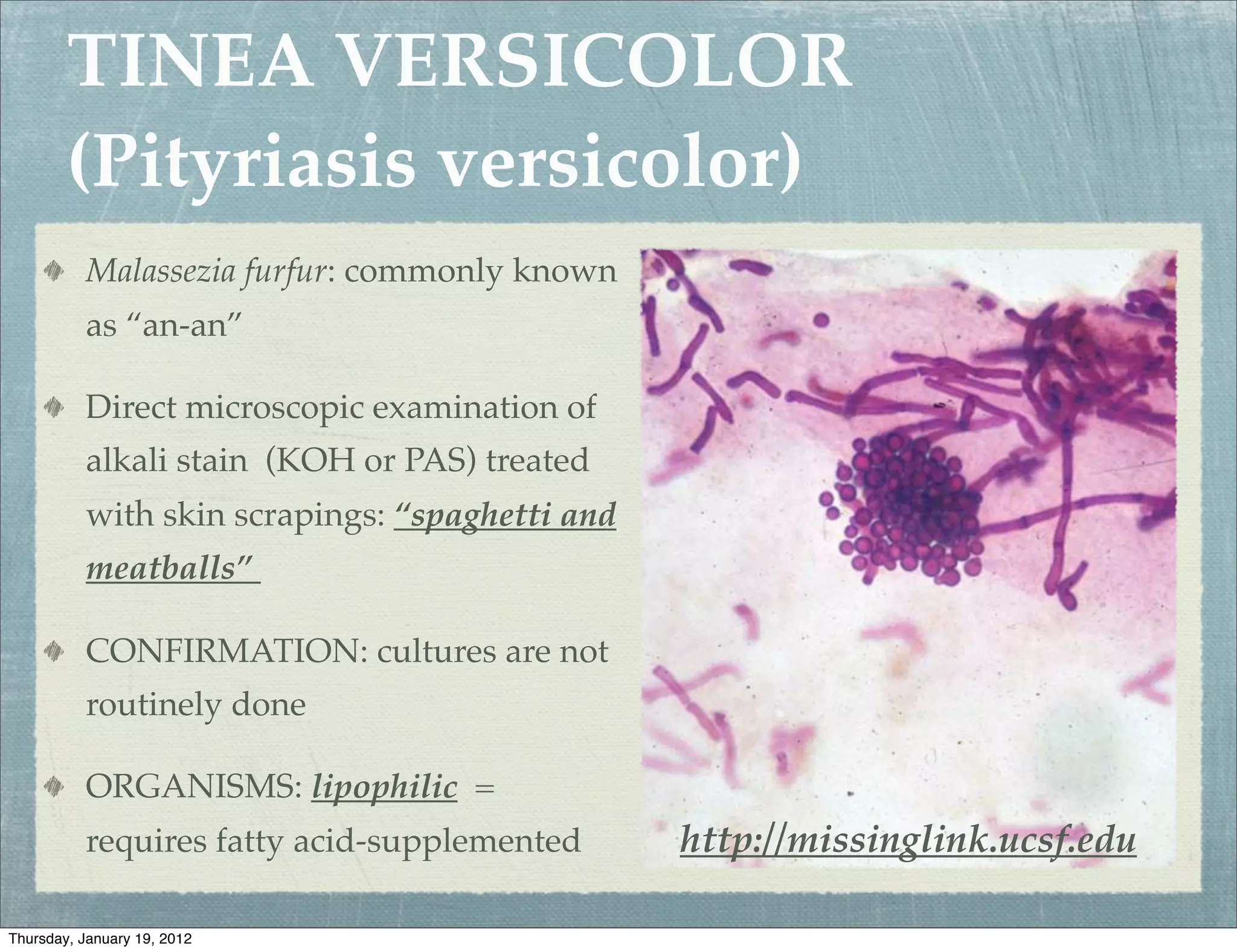 Superficial:cutaneous mycoses | PDF