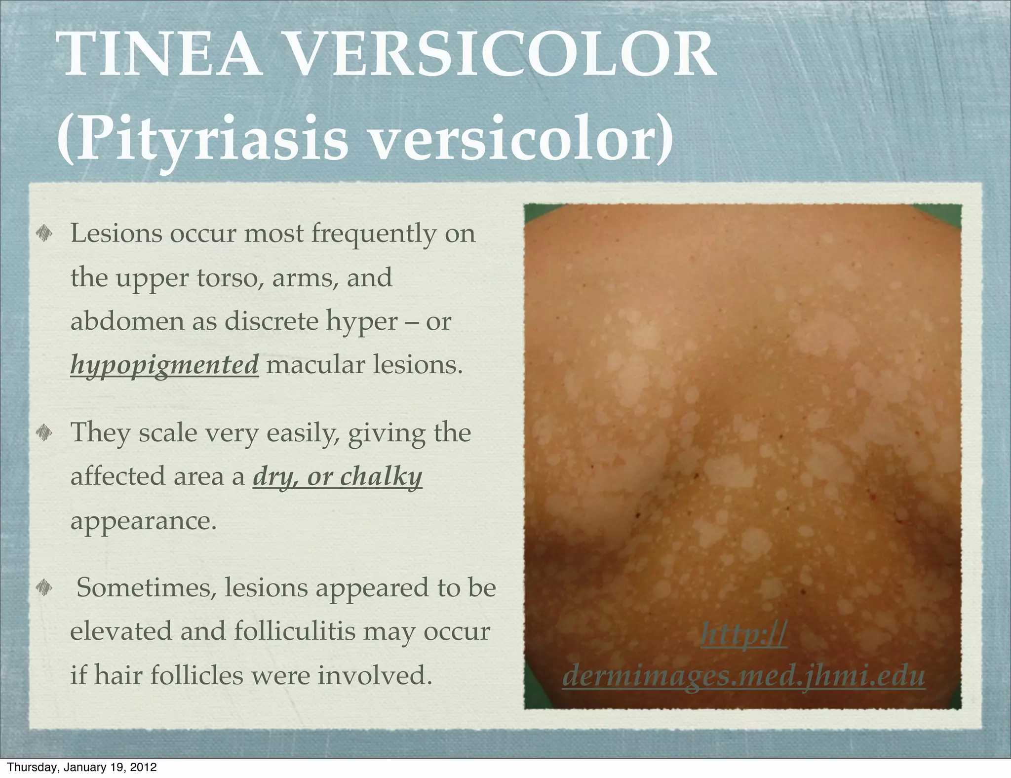 Superficial:cutaneous mycoses | PDF