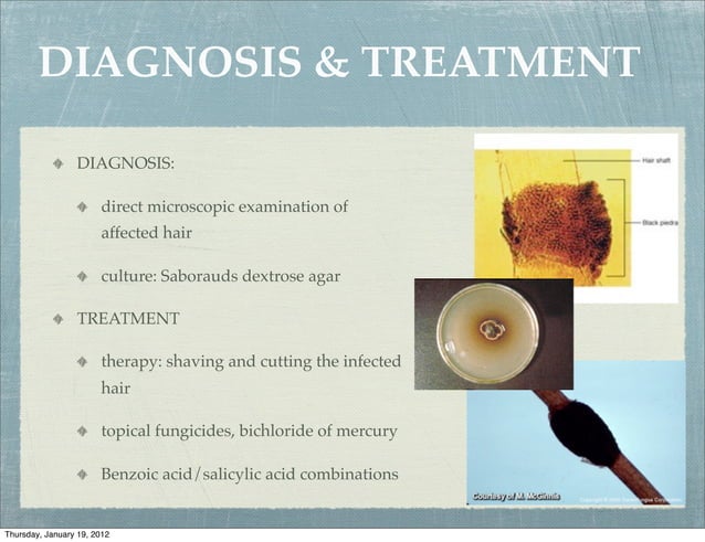 Superficial:cutaneous mycoses | PDF | Skin and Dermatology | Diseases ...