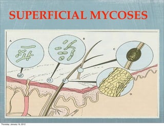 Superficial:cutaneous mycoses | PDF