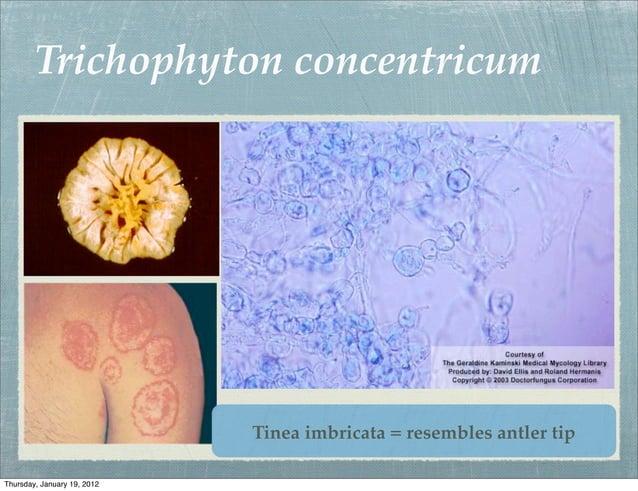 Superficial:cutaneous mycoses | PPT