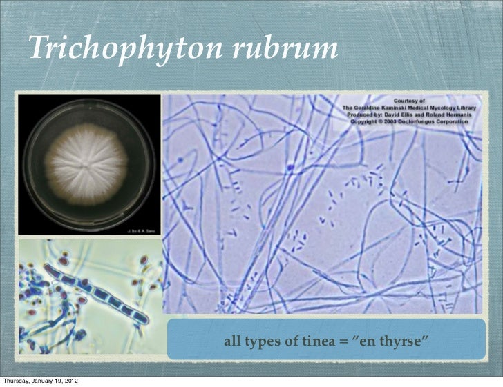 Superficial:cutaneous mycoses