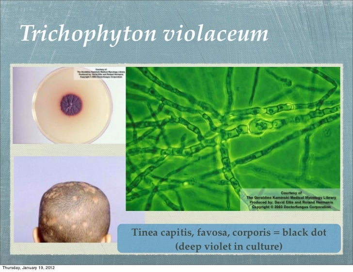 Superficial:cutaneous mycoses