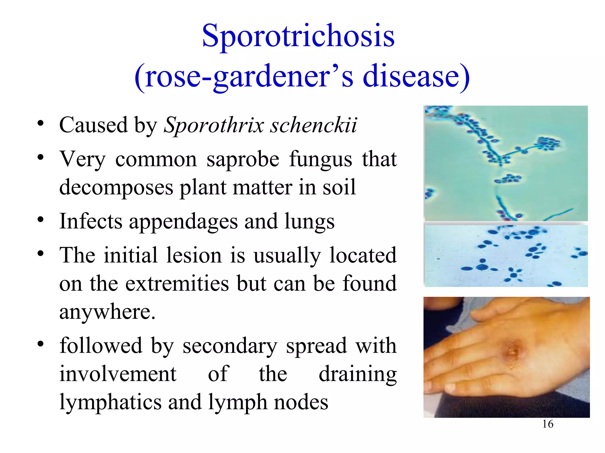 Superficial & cutaneous mycoses | PPT