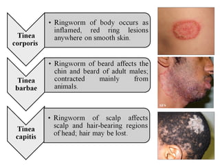 Superficial & cutaneous mycoses | PPT