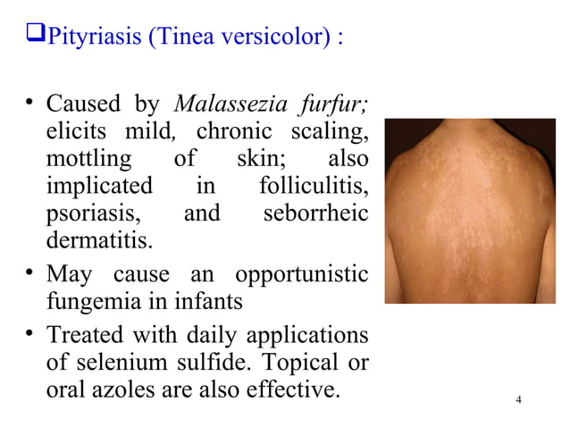 Superficial & cutaneous mycoses | PPT