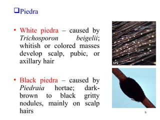 Superficial & cutaneous mycoses | PPT
