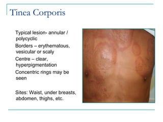 Superficial fungal infections | PPT