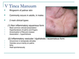 Superficial fungal infections | PPT