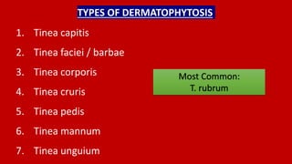 Superficial Fungal Infections | PPTX