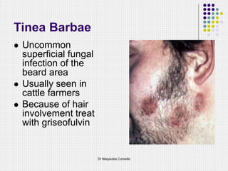 Superficial fungal infections.pdf | Skin Care | Beauty