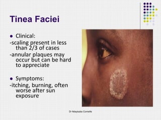 Superficial fungal infections.pdf