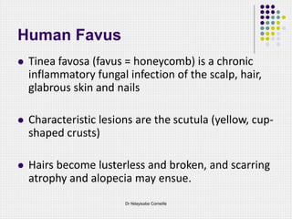 Superficial fungal infections.pdf | Skin Care | Beauty