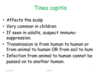 superficial fungal infections.pptx