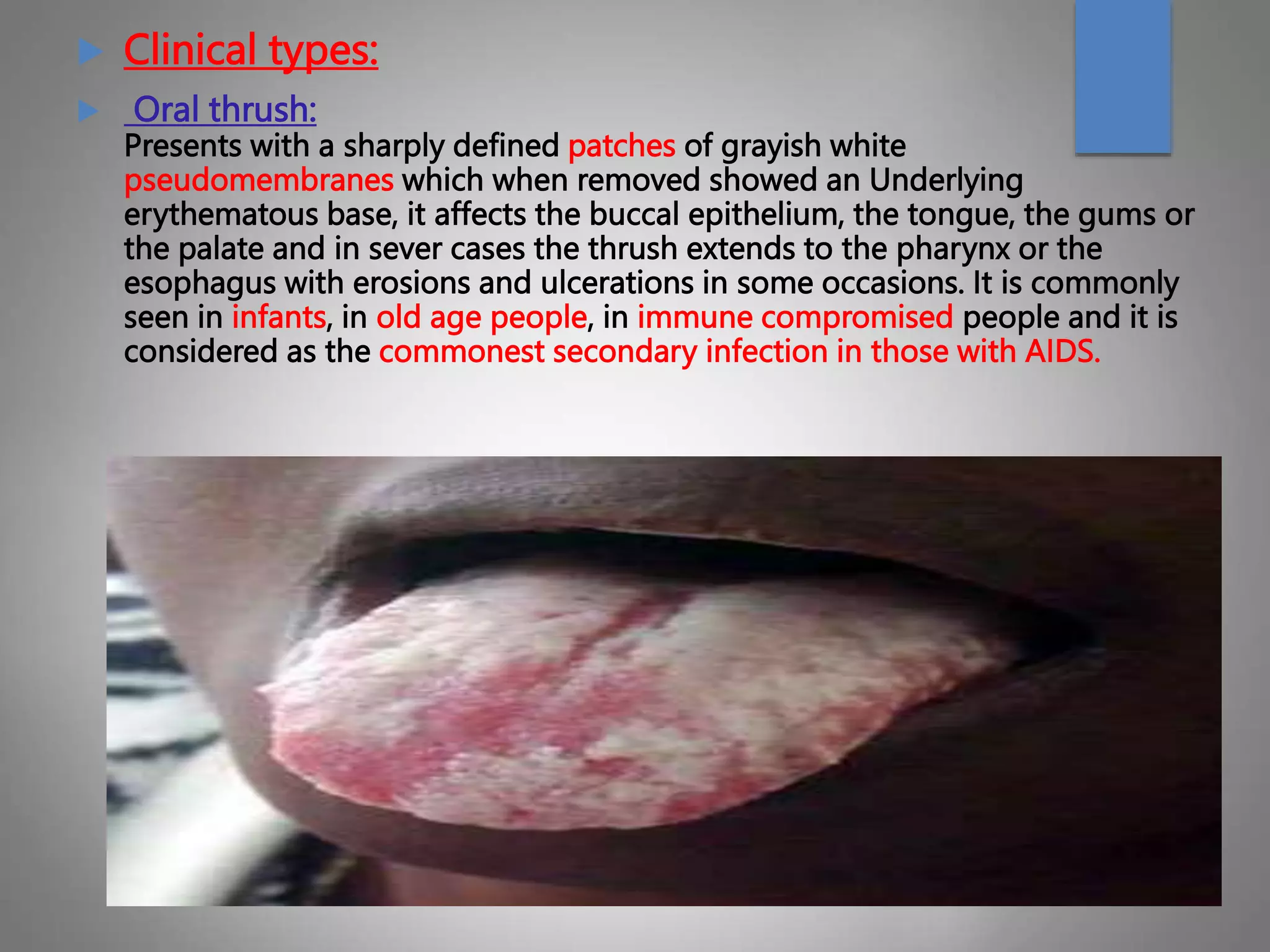 Superficial fungal skin infections.ppt