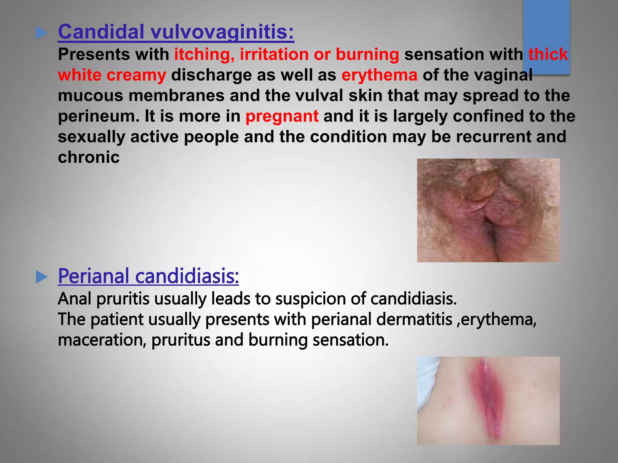 Superficial fungal skin infections.ppt